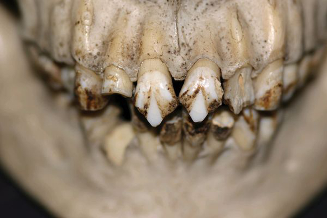 Show Me Your Teeth and I Will Tell You Who You Are